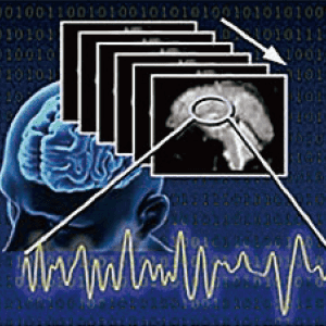 Visualizing brain activity with fMRI