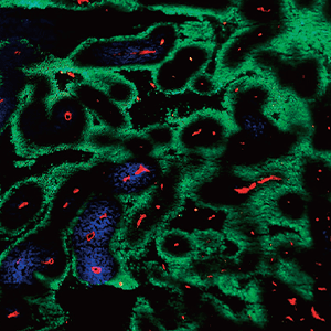 Ghost vessel formation in capillaries is closely associated with ...
