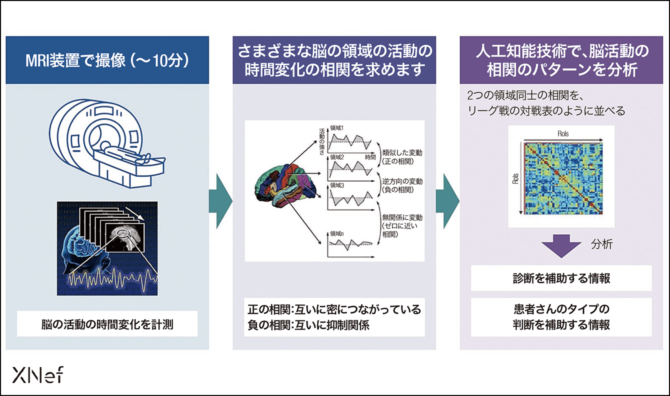 最新fMRIが可能にした脳の動きの「見える化」
