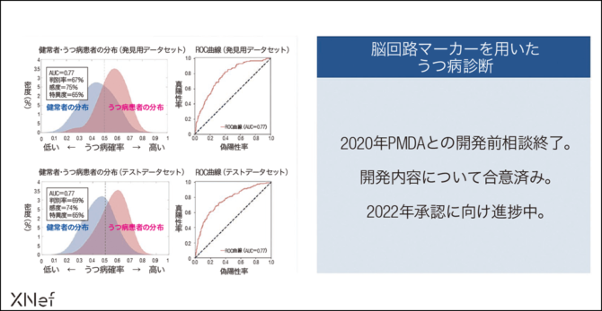 最新fMRIが可能にした脳の動きの「見える化」