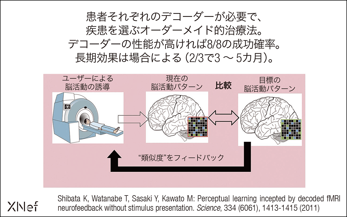 最新fMRIが可能にした脳の動きの「見える化」